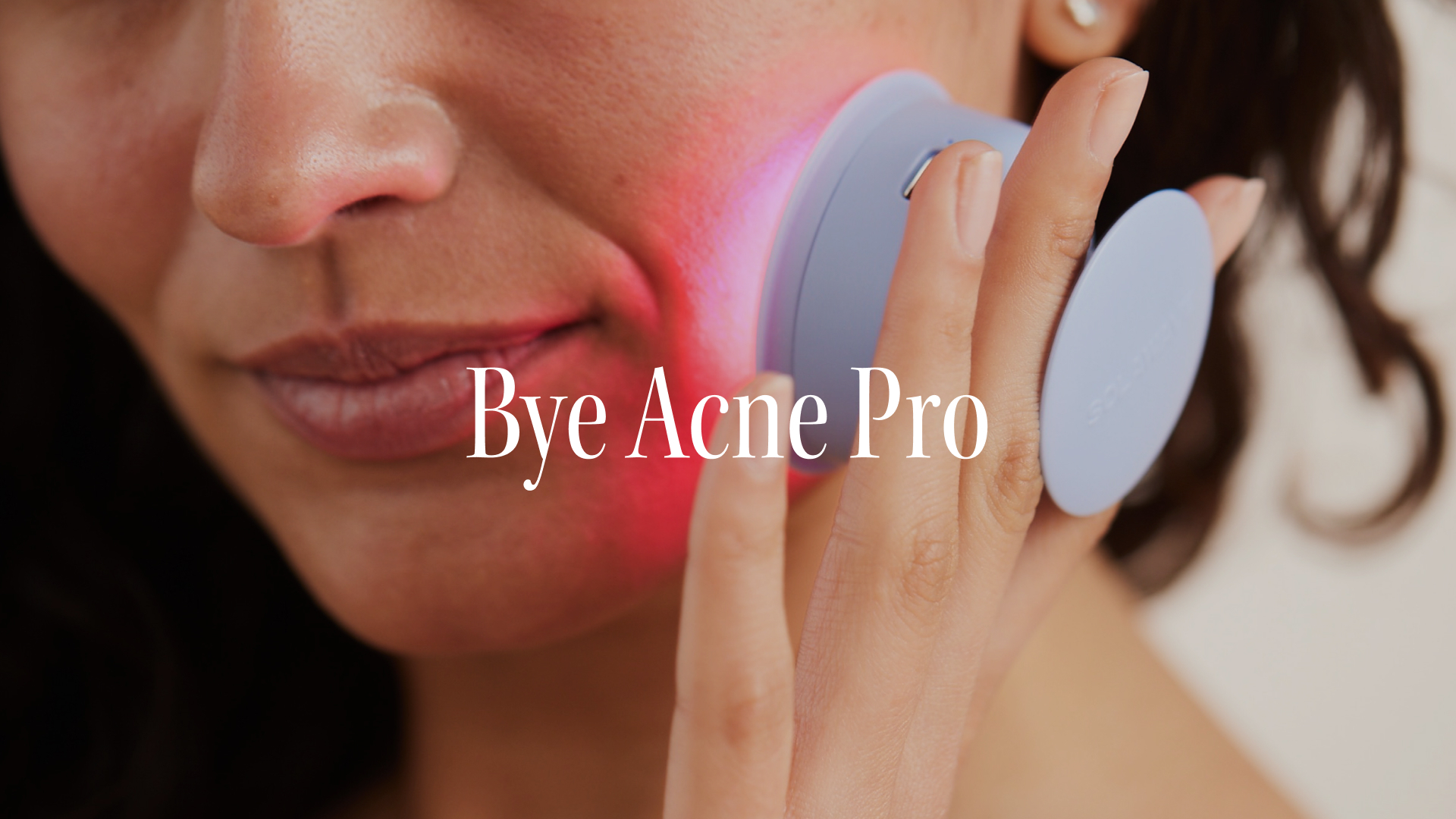 Solawave Bye Acne Spot Treatment V2 - Walmart.com